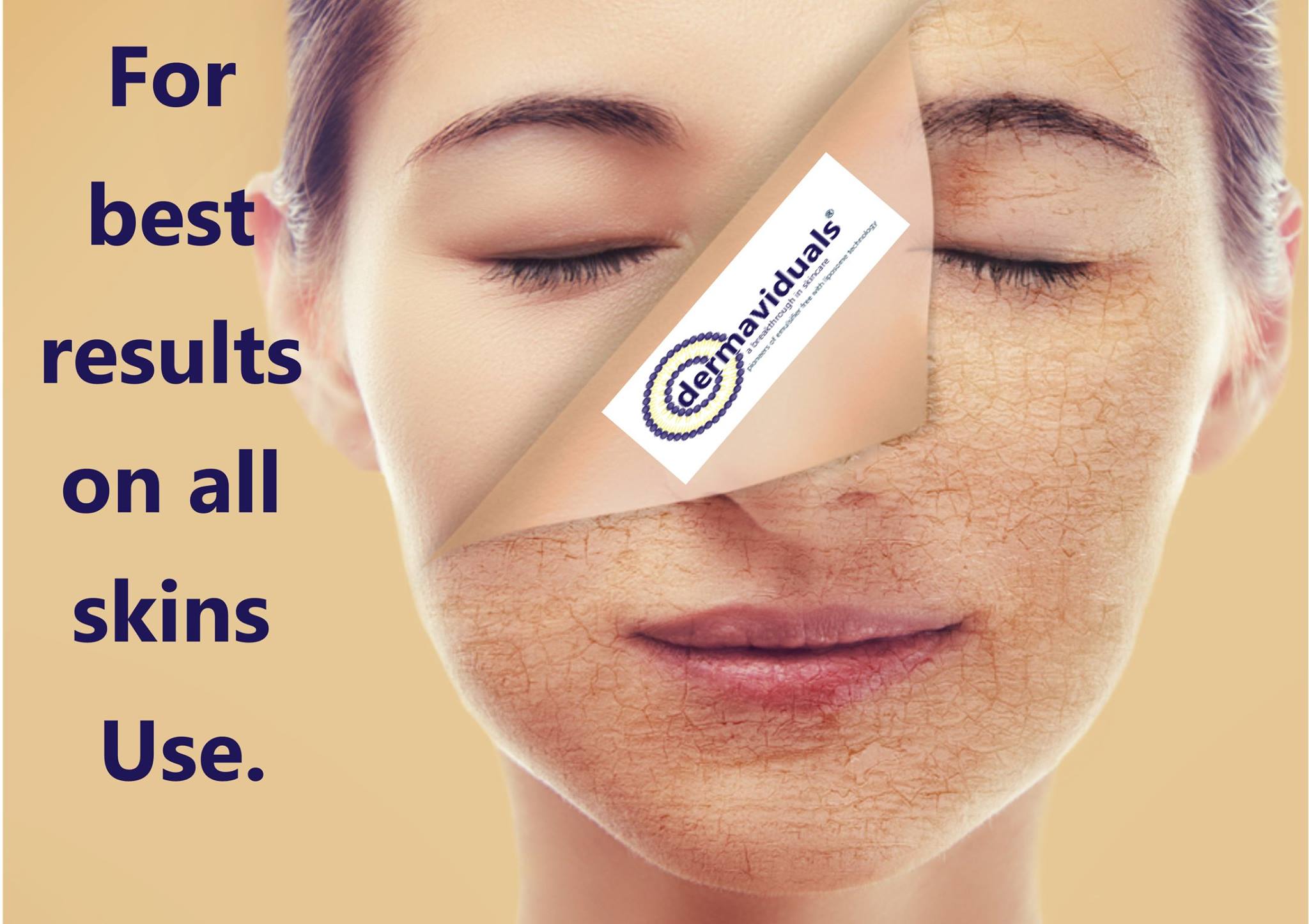 Dry Skin in April? | Temple of Beauty Facial Boutique